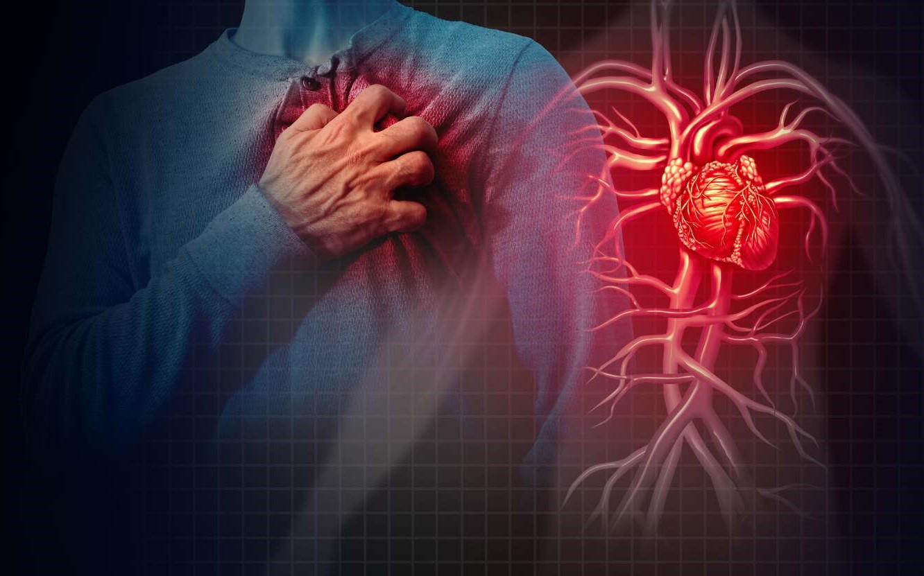 DOENÇA CORONARIANA - ANGINA - Dr Eduardo de Sousa Santos - Cardiologista
